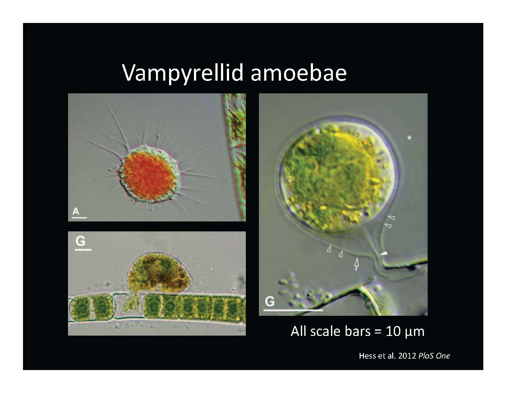 The Bite of the Vampyrellid Amoebae | UC Geography